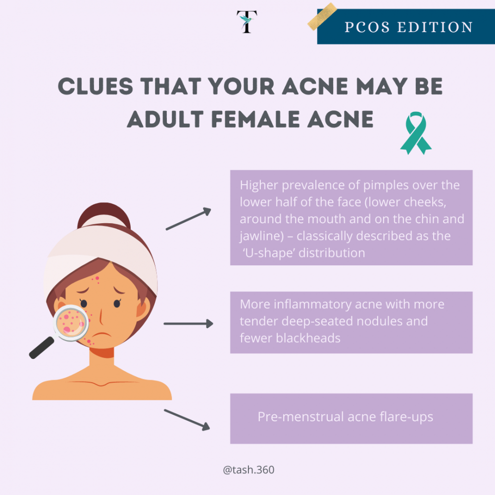 Dermatologist Explains Link Between PCOS and Your Skin | Longevity